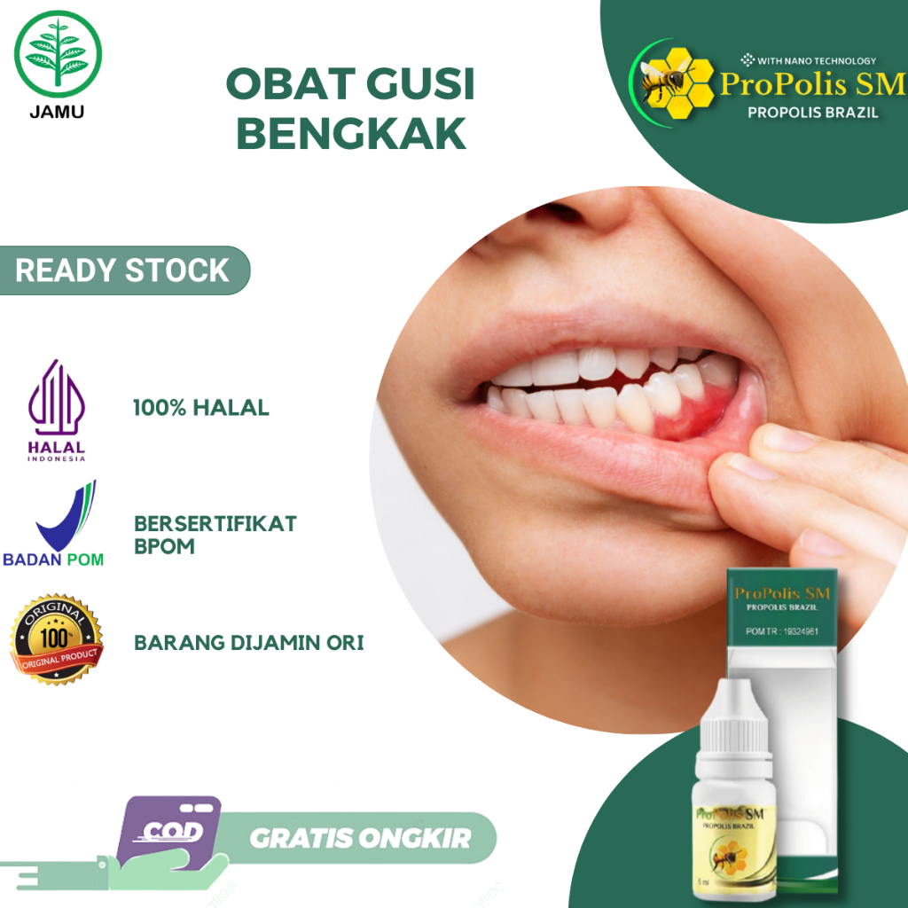 Jual Obat Gusi Bengkak Radang Gusi Berdarah Bernanah Abses Gusi ...