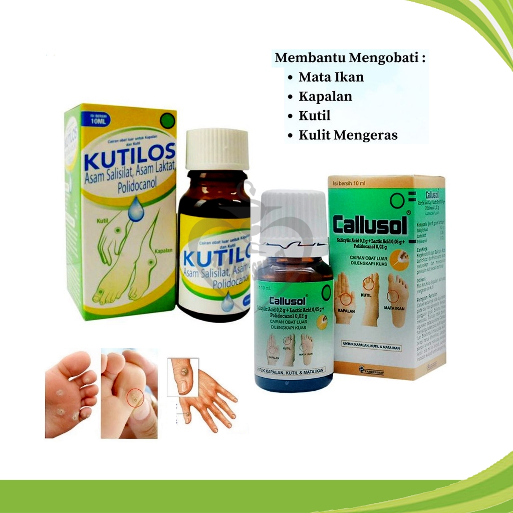 Jual Obat Kutil Mata Ikan Penebalan Kulit Kapalan Callusol dan Kutilos ...
