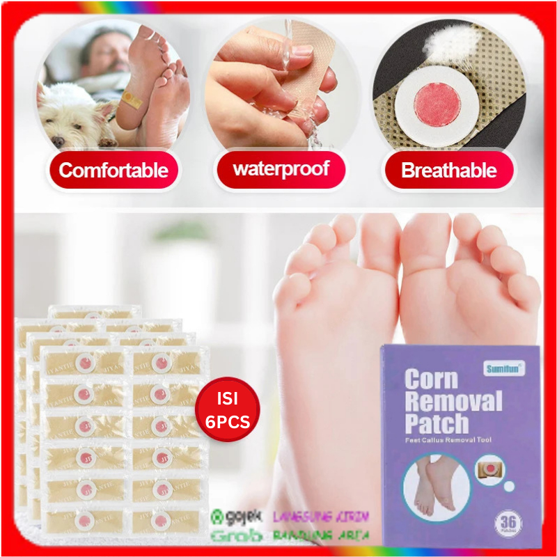 Jual Obat Kutil Kapalan Mata Ikan Kaki/Plester Penghilang Kutil Mata ...