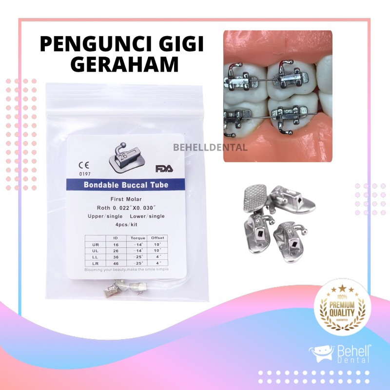 Jual BUCCAL TUBE FDA HIGH QUALITY PENGUNCI BEHEL BRACKET KAWAT GIGI ...