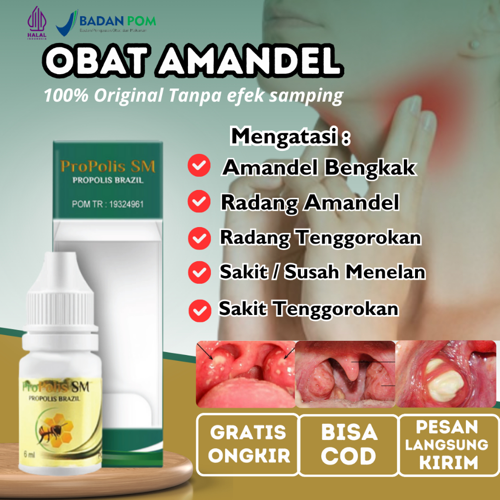 Jual Pengempis Amandel Bengkak, Obat Amandel Anak Dewasa, Obat Radang ...
