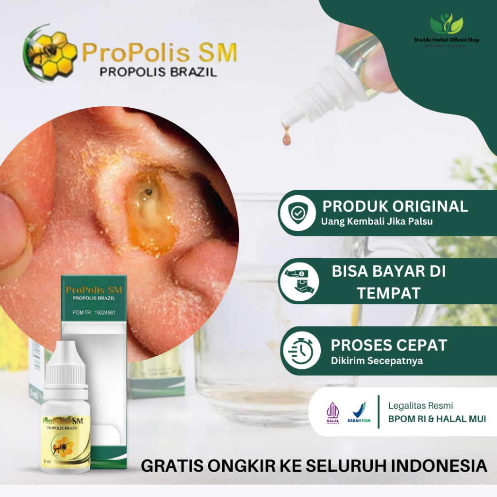 Jual Obat Telinga Gatal, Obat Daun Telinga Gatal, Telinga Gatal Dan ...