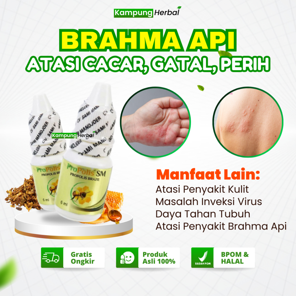 Jual Obat Brahma Api Kulit Gatal Perih Dompo Herpes Zoster Cacar ...