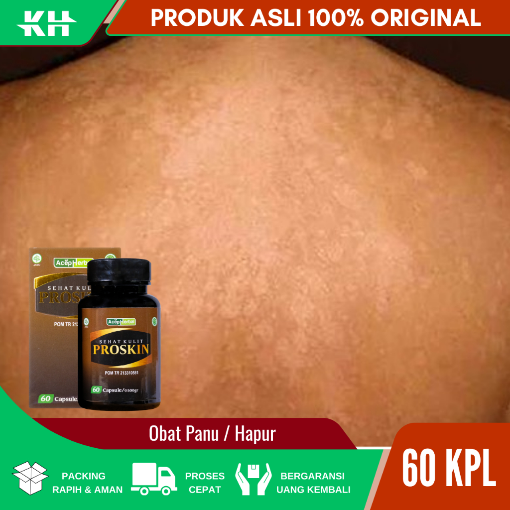 Jual Obat Hapur Kulit, Obat Hapur Di Wajah, Obat Hapuran, Obat Hapur ...