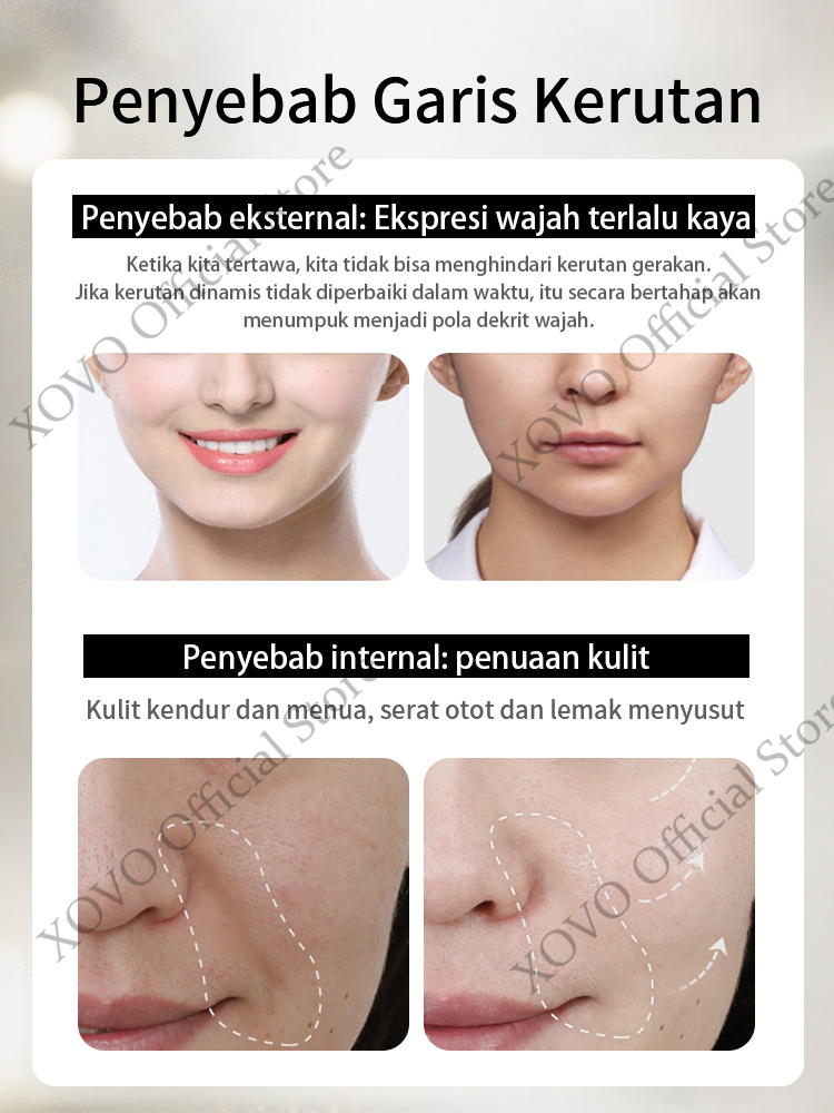 Jual Masker Seomou Lipatan Nasolabial Mikrokristalin Kental ...