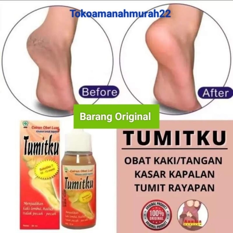 Jual Tumitku Original Obat Kaki Kapalan Tumit Pecah-pecah Bonus Kapas ...