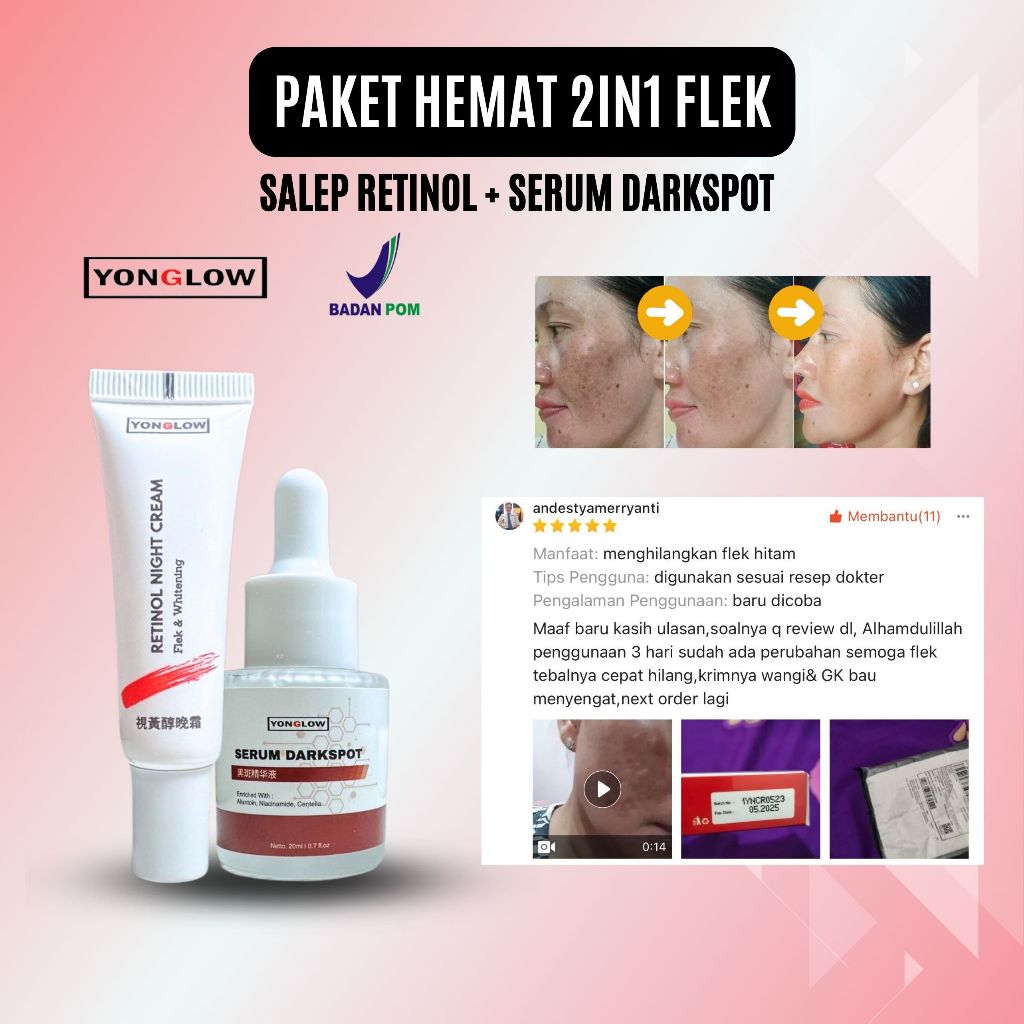 Jual Paket 2in1 BPOM Yonglow Skincare Salep Cina BPOM Flek Hitam Melasm Bintik Bekas Jerawat ...