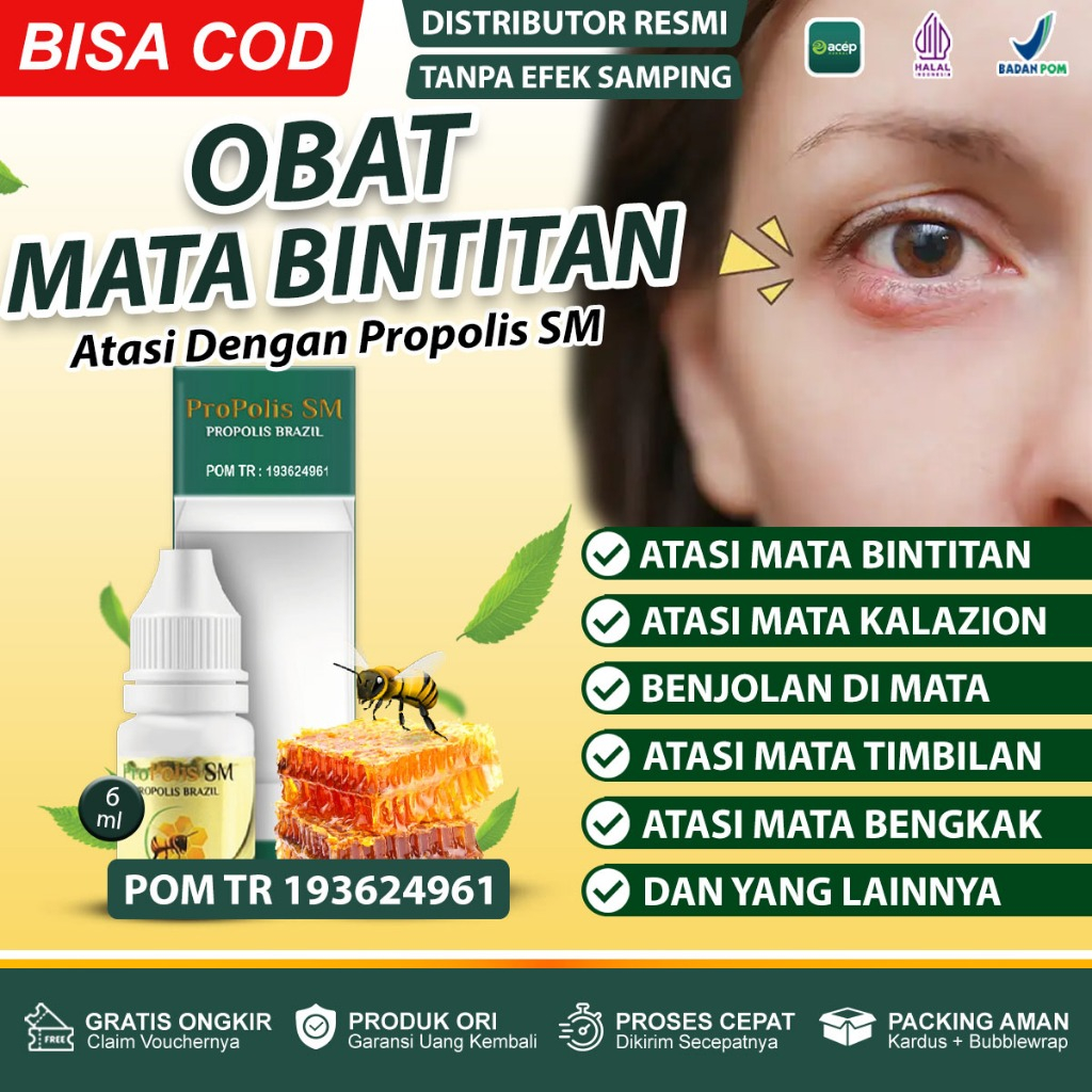 Jual Obat Mata Bintitan Kalazion Timbilan Mata Timbilan Bernanah Mata ...