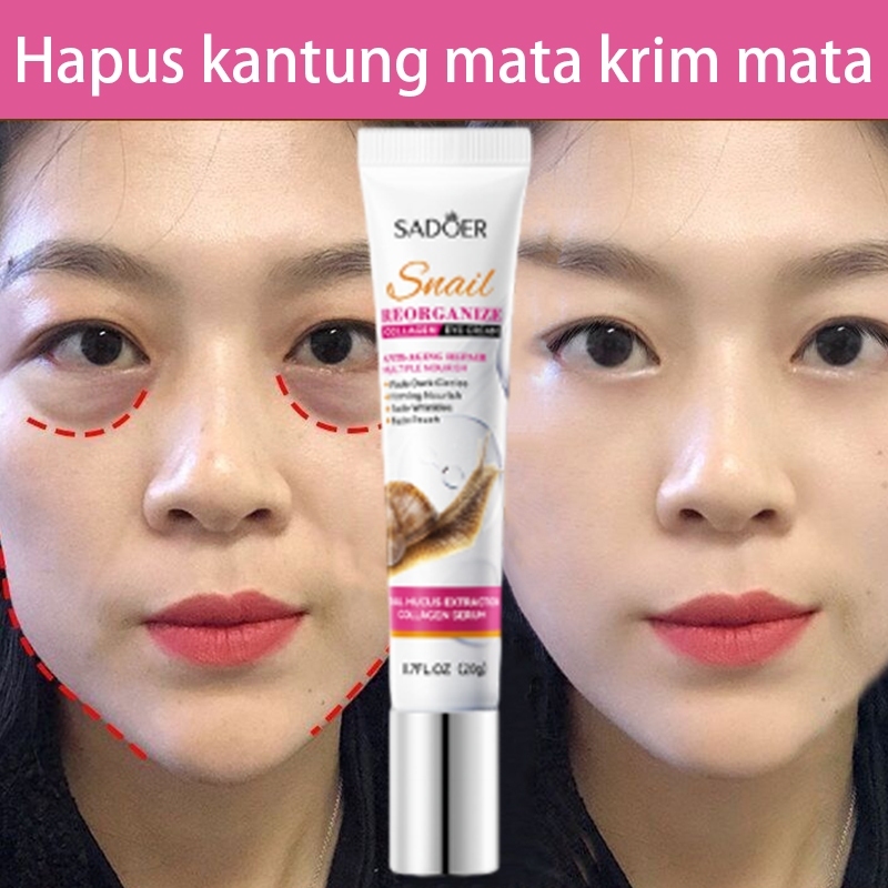 Jual Eye Cream Menghilangkan Mata Panda Penghilang Kantung Mata Krim ...