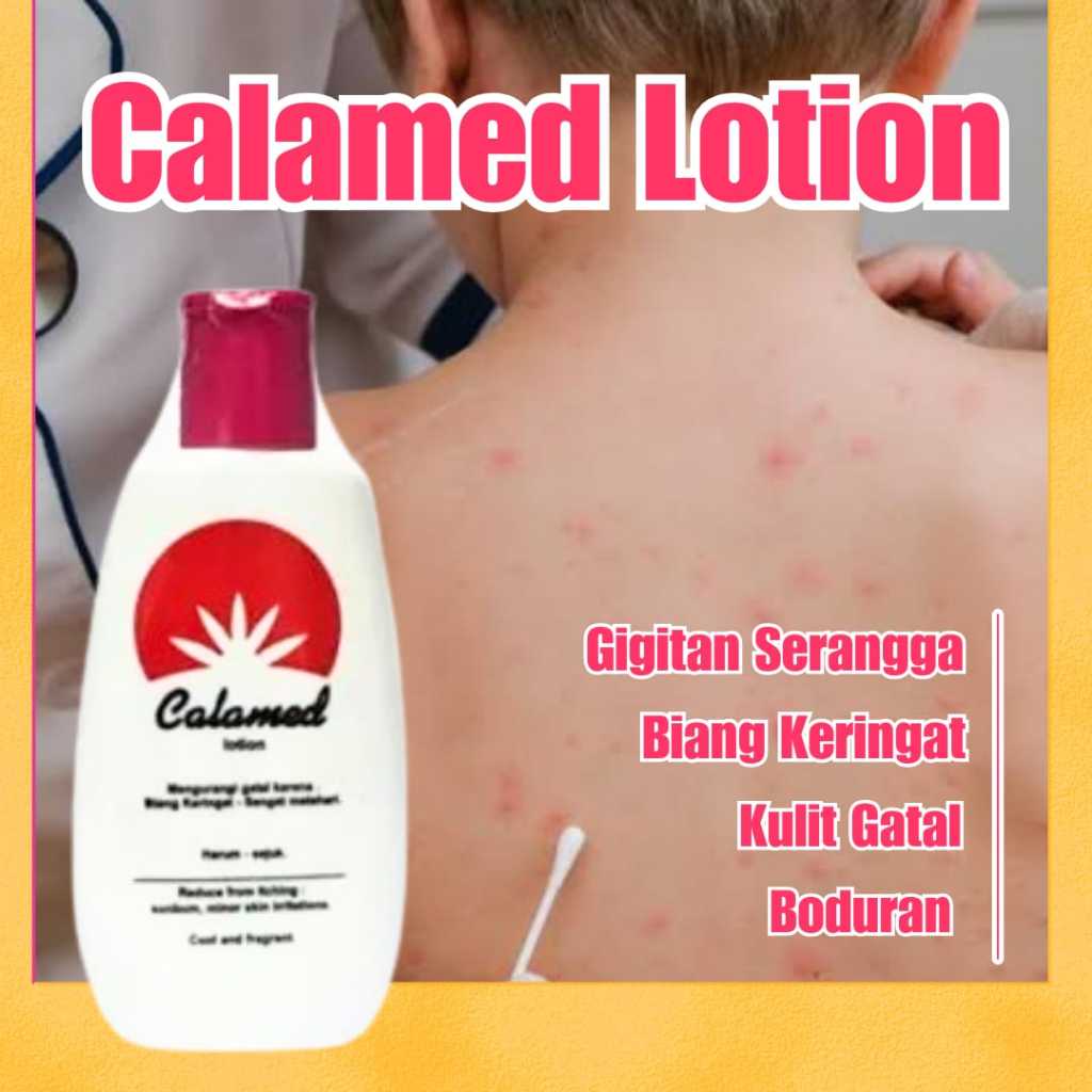Jual Calamed Lotion bedak Cair untuk gatal anak dan keluarga | Shopee ...