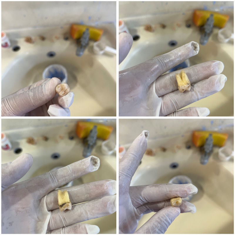 Jual gigi molar | Shopee Indonesia