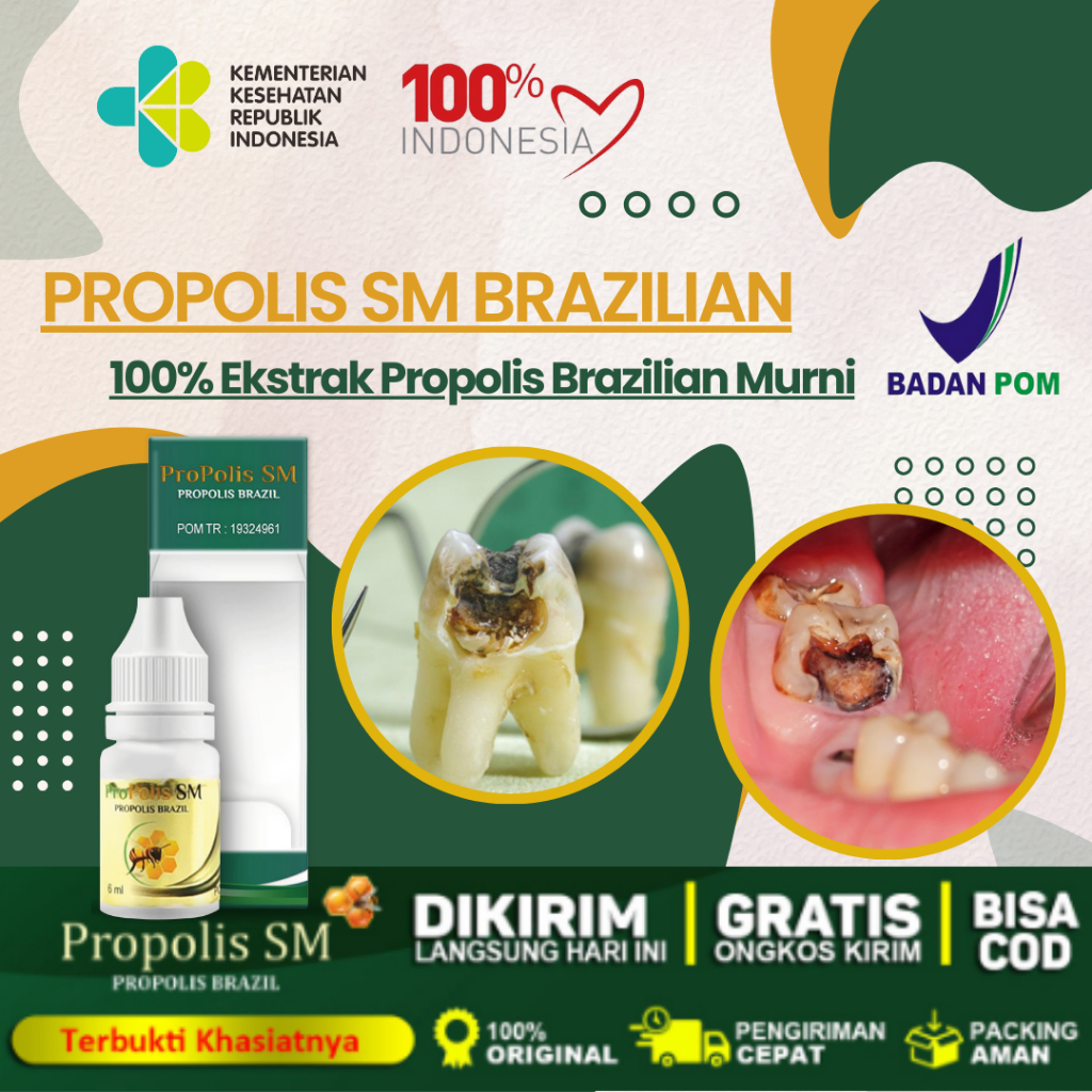 Jual Obat Sakit Gigi Berlubang Nyeri Linu Gusi Bengkak Atasi Sariawan Di Bibir Propolis SM ...