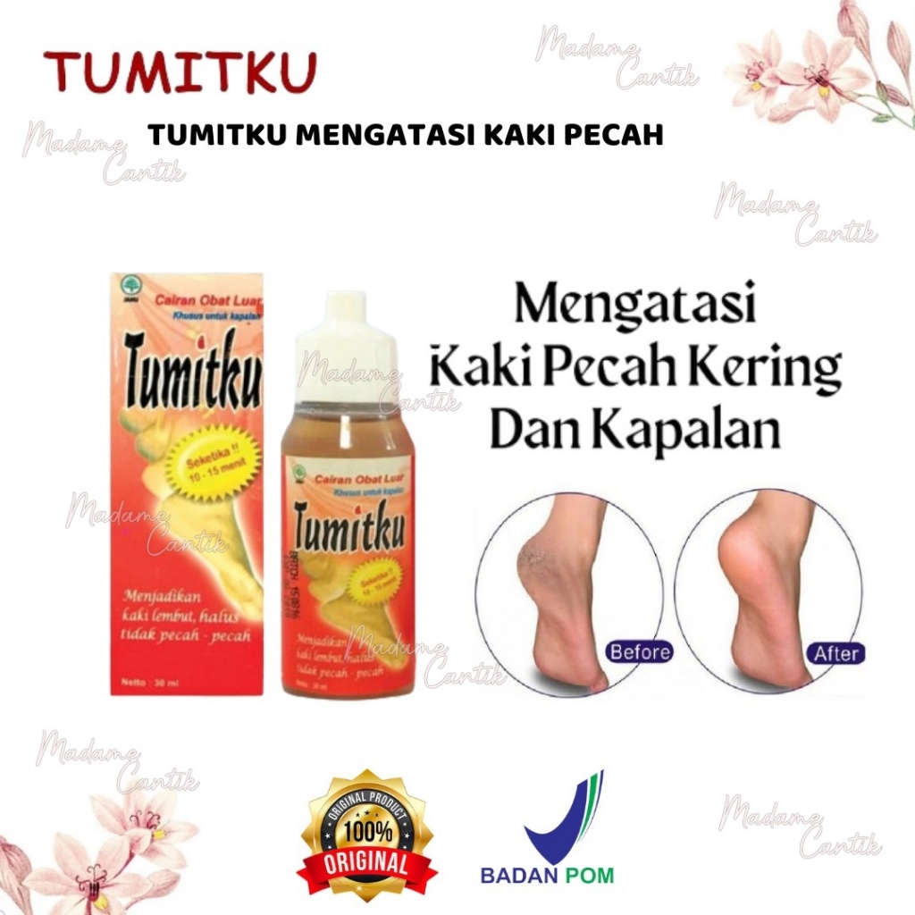 Jual MADAME TUMITKU MENGATASI KAKI PECAH KAPALAN DENGAN INSTAN BPOM ...