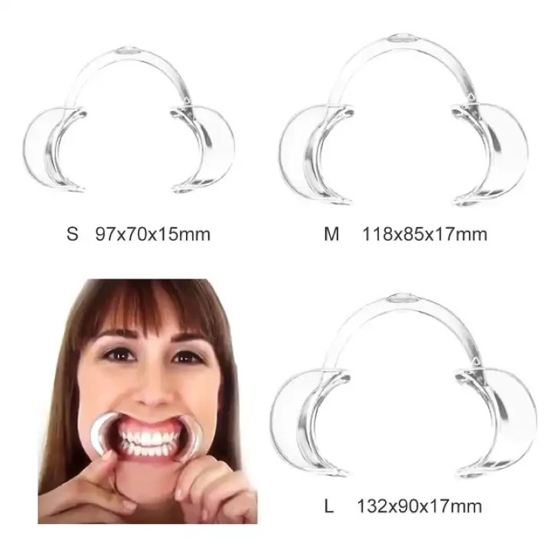 Jual Dental pembuka mulut bibir / mouth retractor / cheek retractor ...