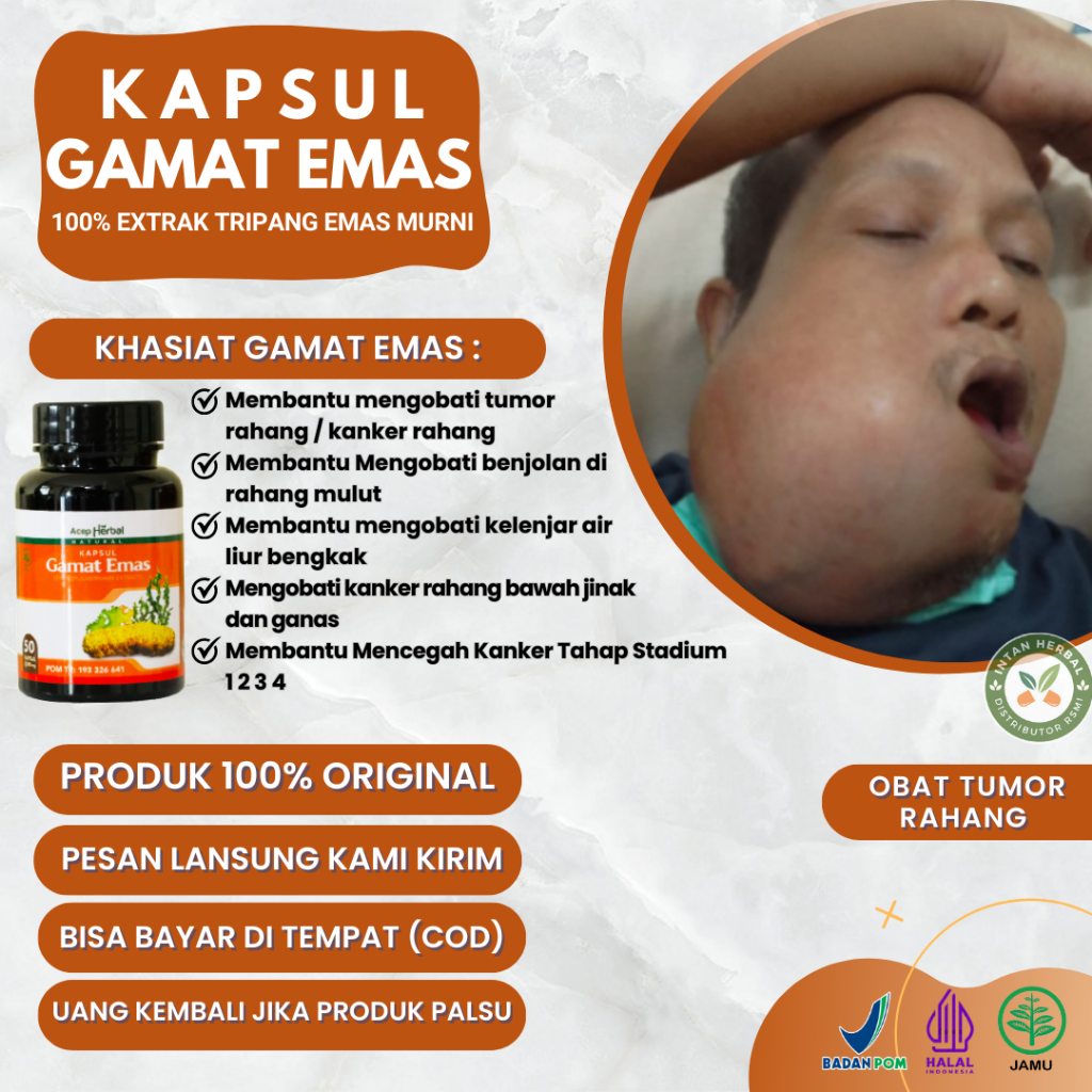 Jual Kapsul Gamat Emas - Obat Tumor Rahang, Benjolan Di Rahang Mulut ...