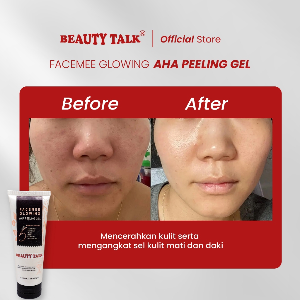 Jual BEAUTY TALK AHA Peeling Gel 6 Jewelry Complex 100ML | Pengangkat ...