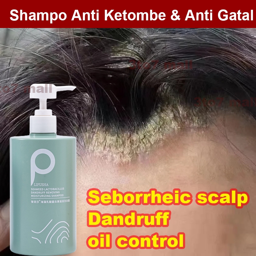 Jual shampoo anti ketombe dan rontok 500ml Anti Gatal perawatan rambut ketombe Garam Laut ...