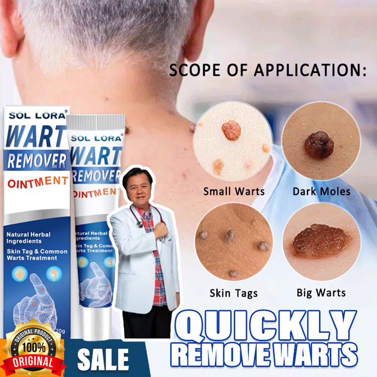 Jual Obat Salep Ampuh Penghilang Tahi Lalat & Kutil 20g Skin Tag Wart ...