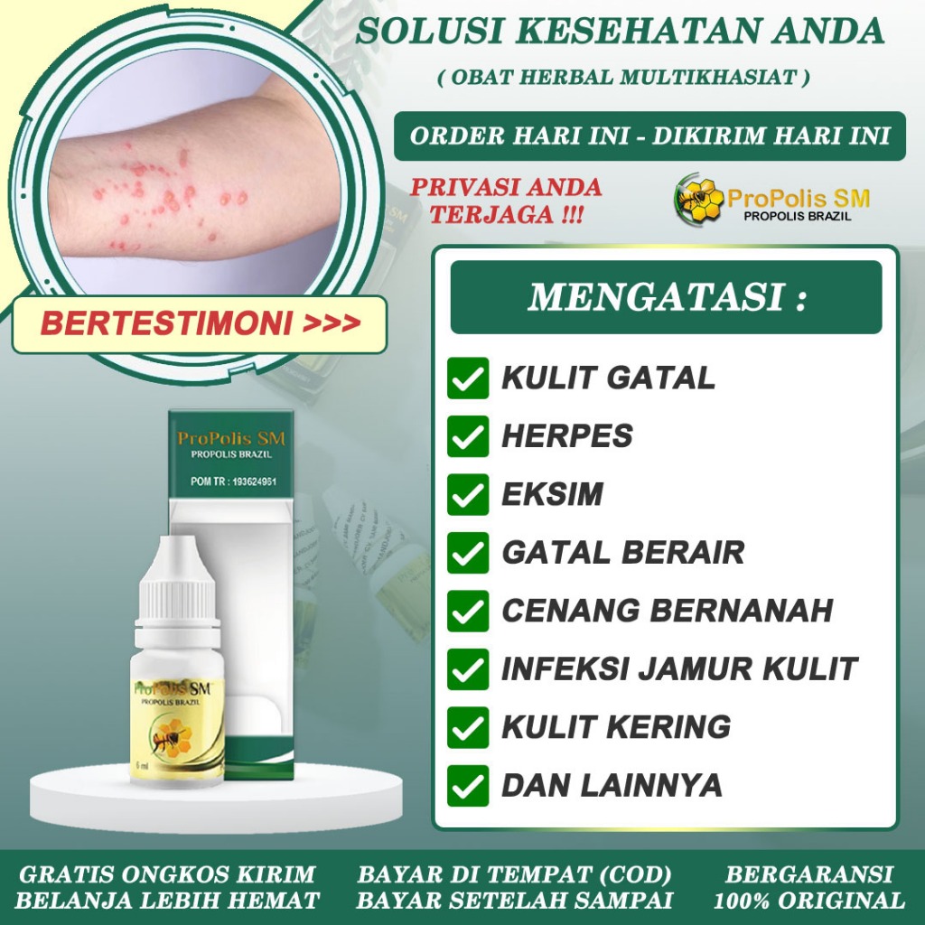 Jual Obat Herpes Kulit Gatal Berair Menyebar Eksim Kering Menahun ...