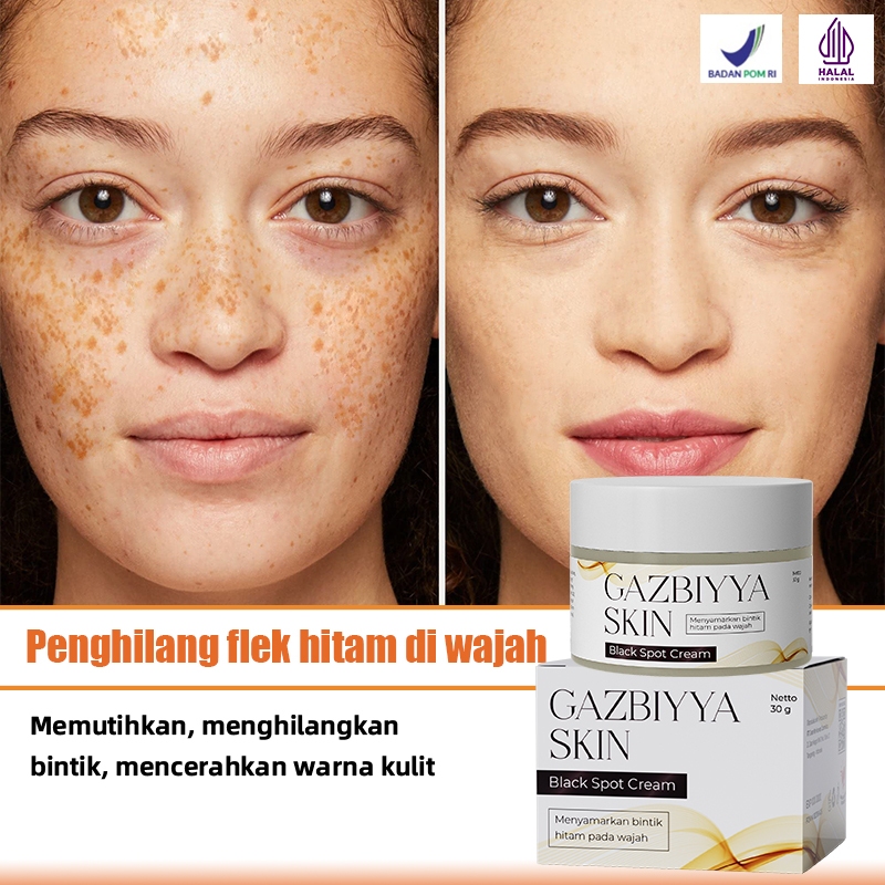 Jual Cream flek hitam membandel Cream penghilang flek hitam ...