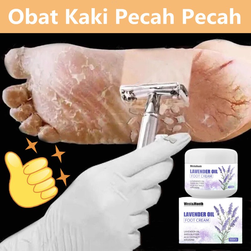 Jual Obat Kaki Pecah Pecah Menghaluskan Melembutkan Kaki dan Tangan ...