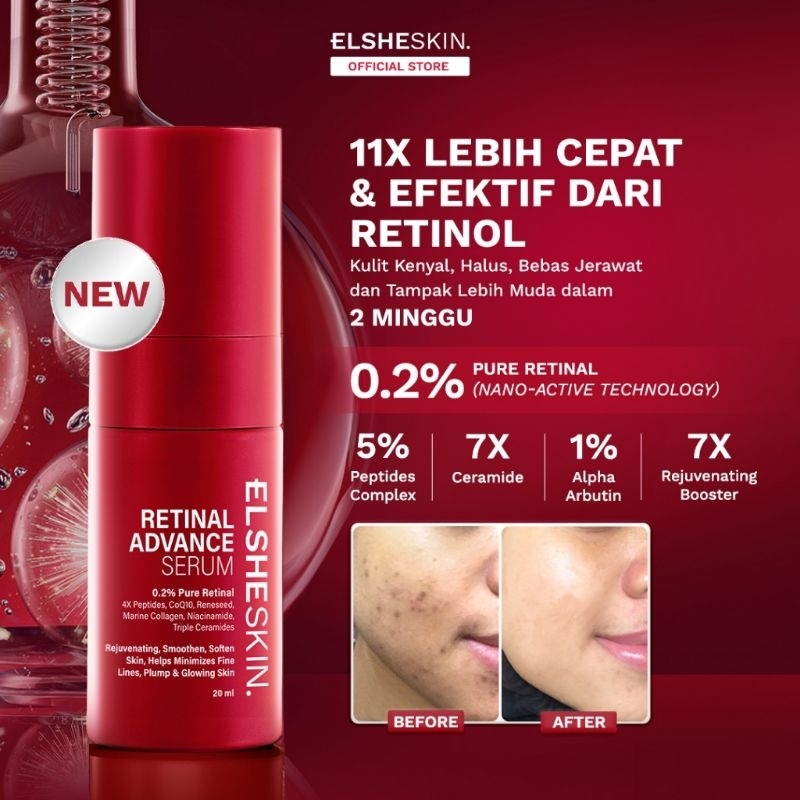 Jual [20mL | 30mL] ELSHESKIN Retinal Advance Serum | 20mL / 30mL | EXP ...