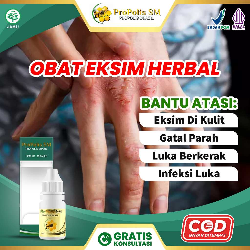 Jual Obat Herbal Propolis SM Vitamin dan Suplemen Untuk Atasi Penyakit ...