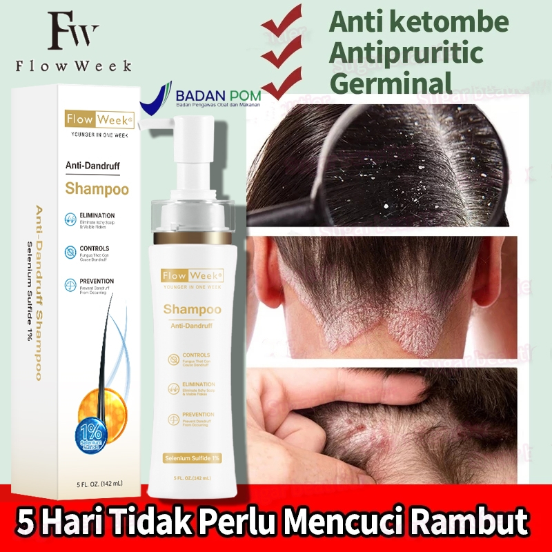 Jual Flowweek Obat Ketombe Sampo Anti Ketombe Dan Gatal Shampoo Kulit Kepala Gatal Psoriasis ...