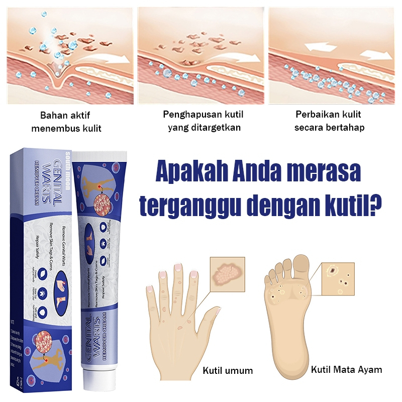 Jual Penghilang Kutil Dan Tahi Lalat Obat Penghilang Kutil Di Wajah ...