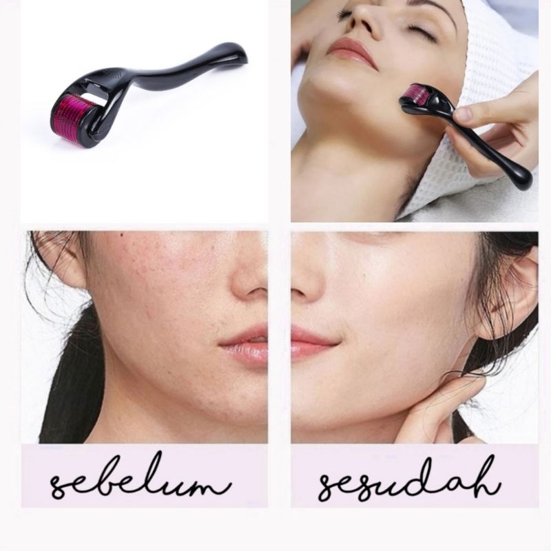 Jual RB Dermaroller 1 mm - Derma Roller System / Alat Anti Aging / Alat ...