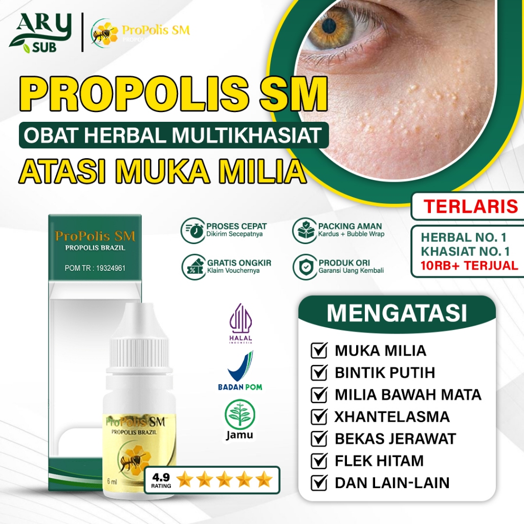 Jual Obat Muka Milia, Milea, Penghilang Milia di Wajah Propolis SM ...