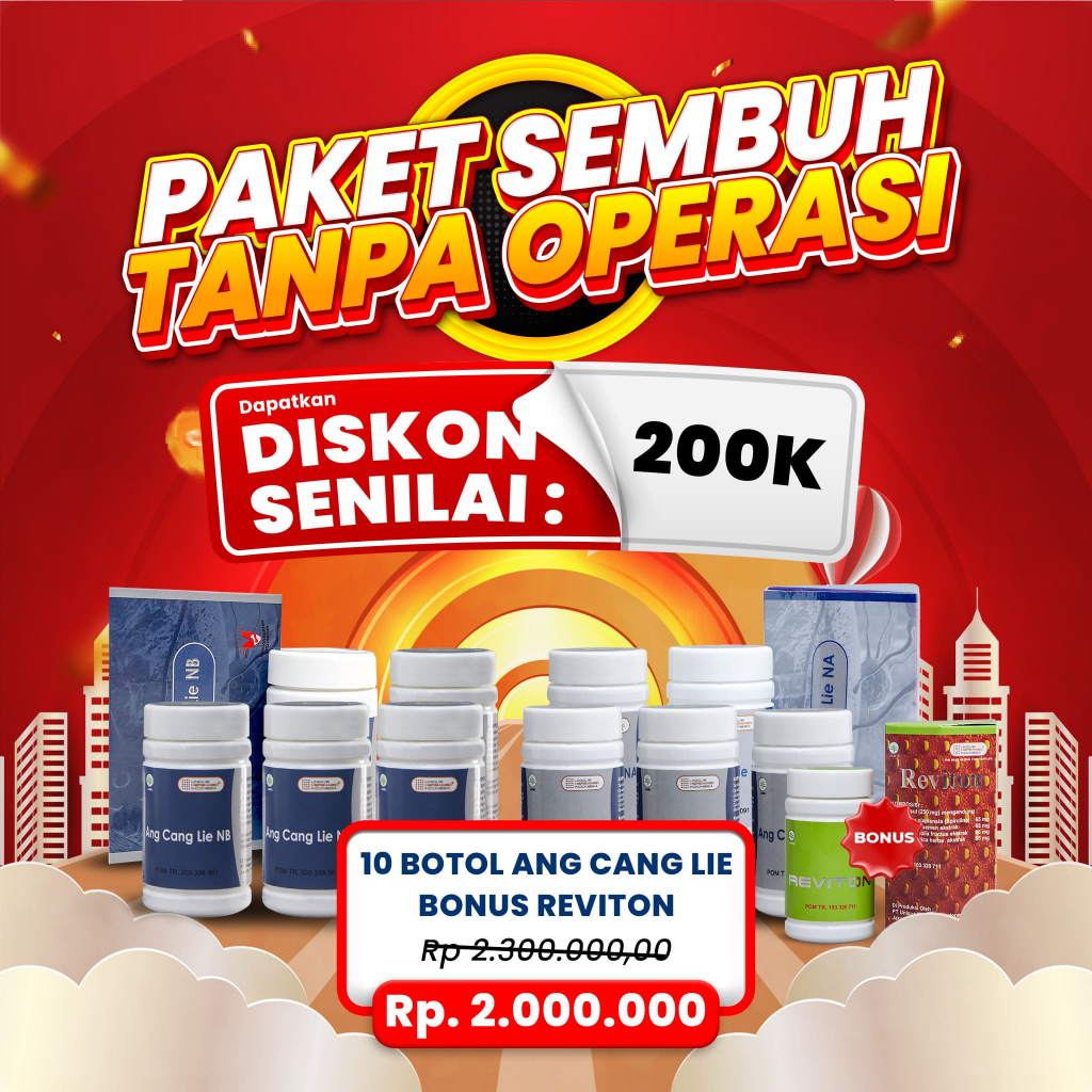Jual Paket Sembuh Tanpa Operasi Ang Cang Lie + Reviton Obat Herbal ...
