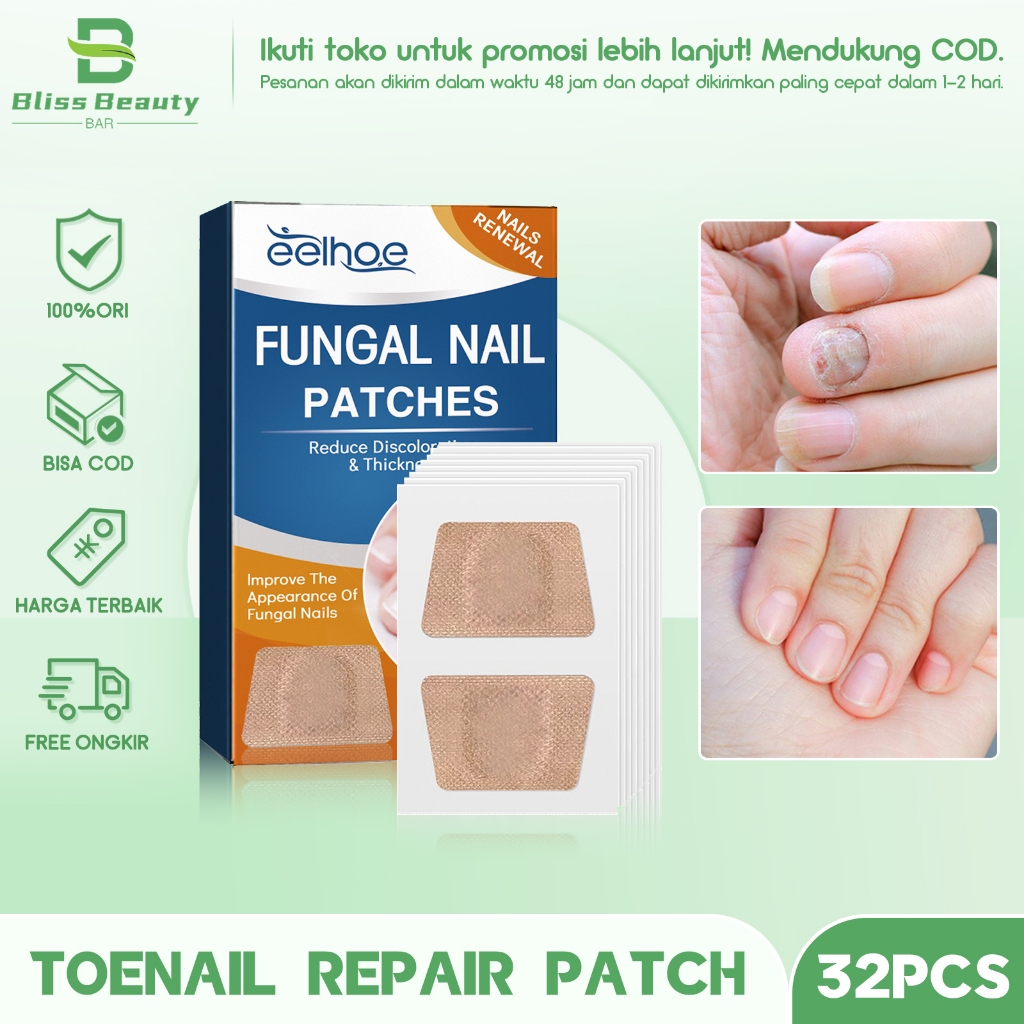 Jual EELHOE Fungal Nail Patches 32pcs - Sticker Kuku Kaki Toenail ...