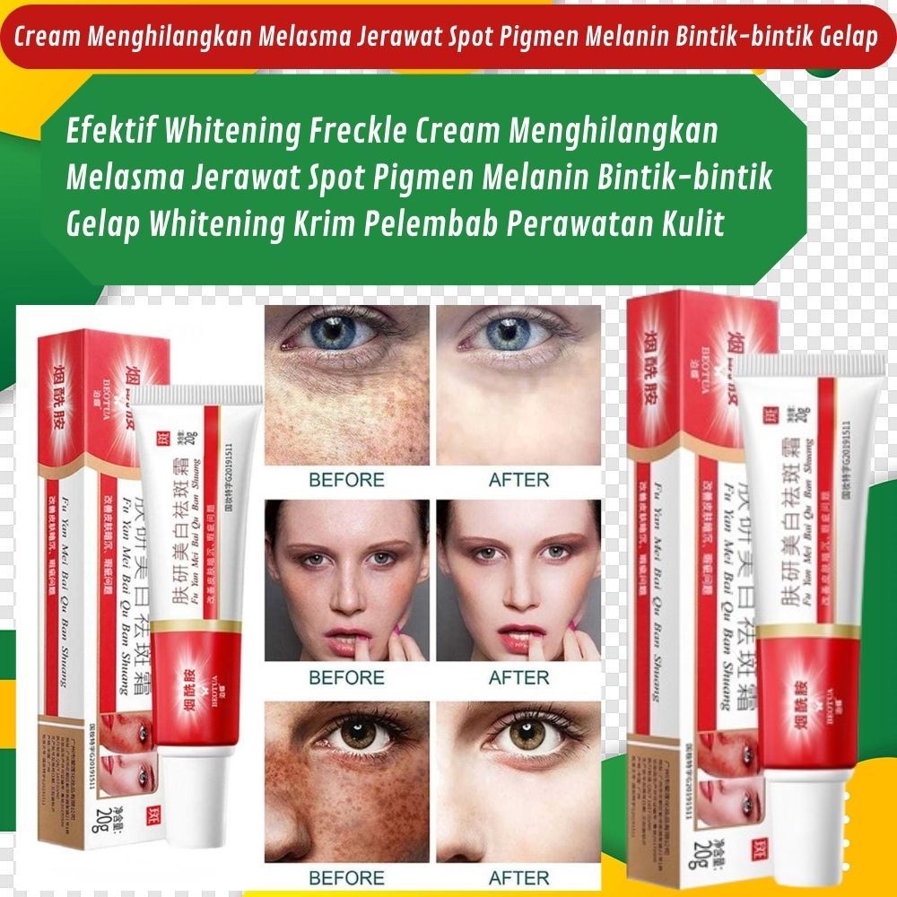Jual Cream Crem Crim Salep Penghilang Flak Hitam / Krim Pemutih ...