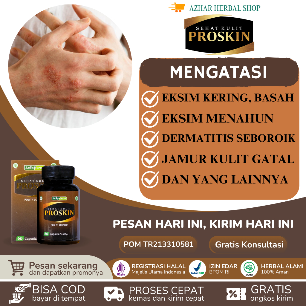 Jual Proskin - Obat Eksim Kering Menahun Basah Dermatitis Seboroik ...