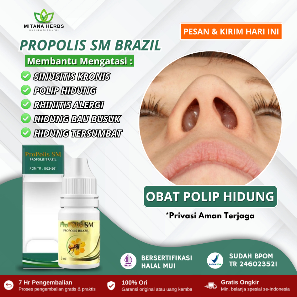 Jual Obat Polip Hidung, Obat Sinusitis, Hidung Bau Busuk Hidung Tersumbat Rhinitis Alergi ...