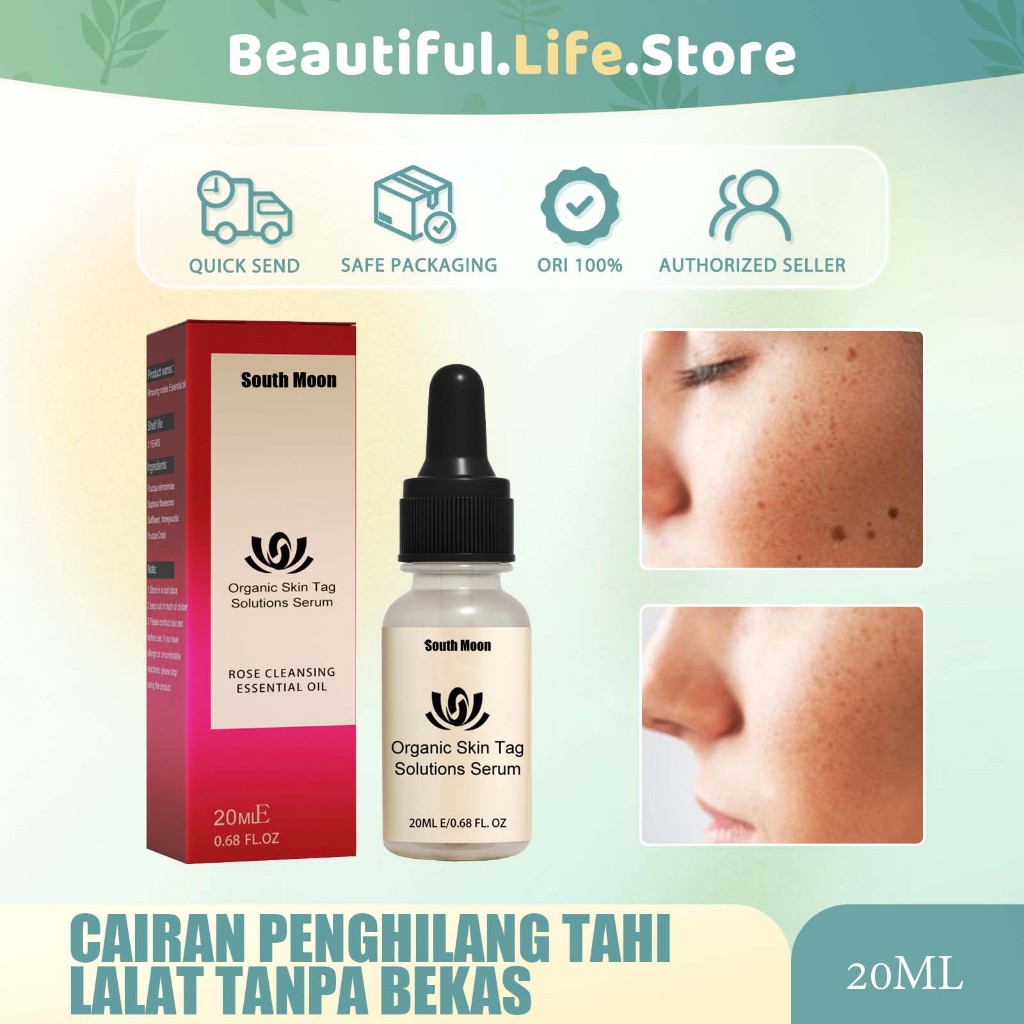 Jual SOUTH MOON Cairan Penghilang Tahi Lalat Tanpa Bekas 20ml Minyak ...