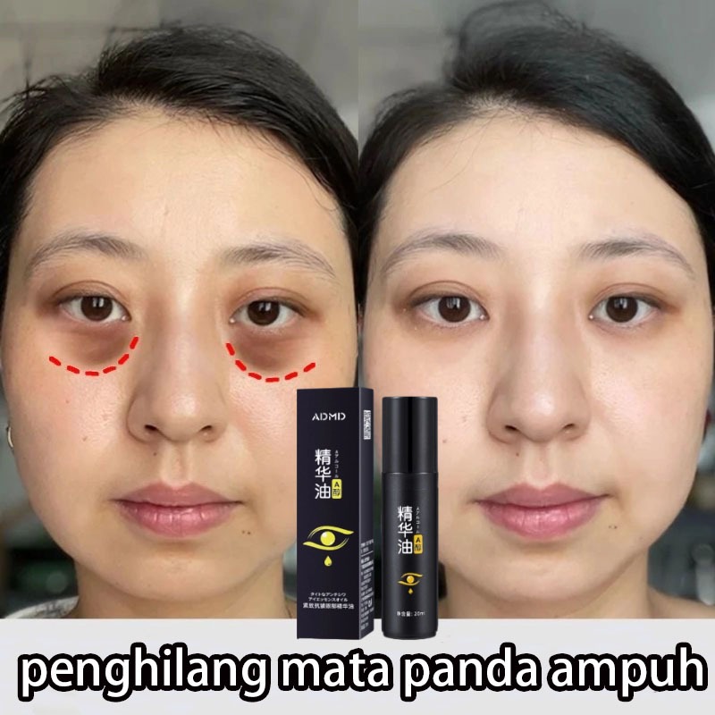 Jual eye cream penghilang mata panda ampuh eye serum the originote krim mata panda dan kerutan ...