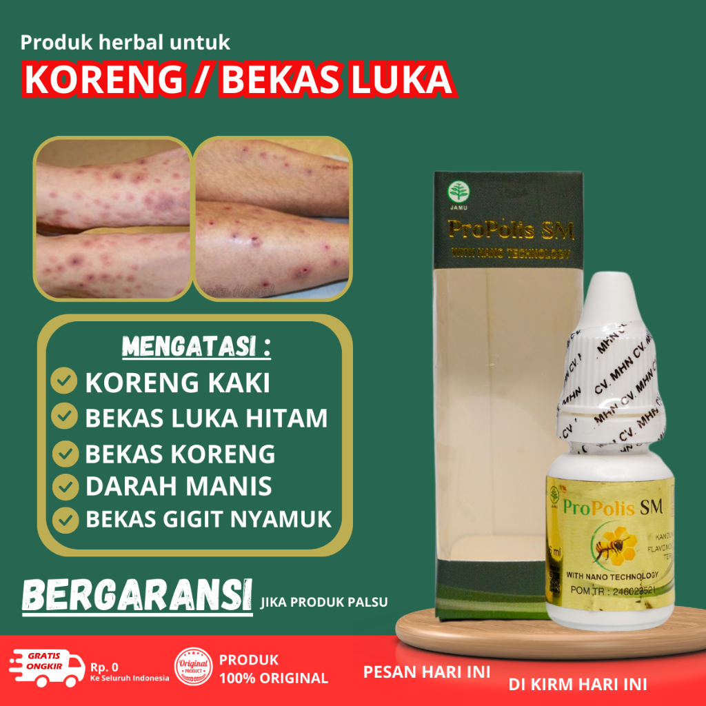 Jual Obat Penghilang Koreng di Kaki - Penghilang bekas Luka di kaki ...
