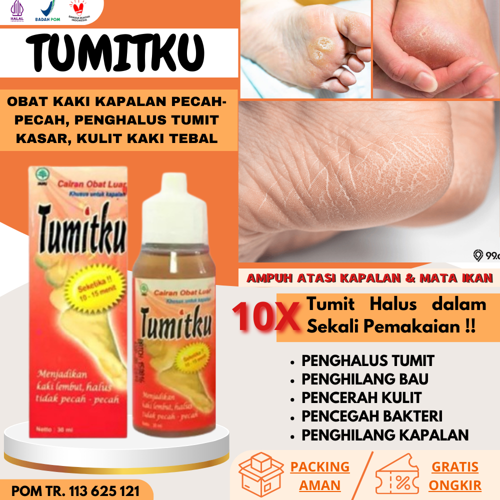 Jual Tumitku - Obat Kapalan dan Kaki Pecah-Pecah, Penghalus Tumit Kaki ...