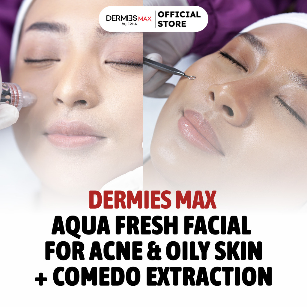 Jual Dermies Max Aqua Fresh Facial for Acne & Oily Skin + Comedo ...