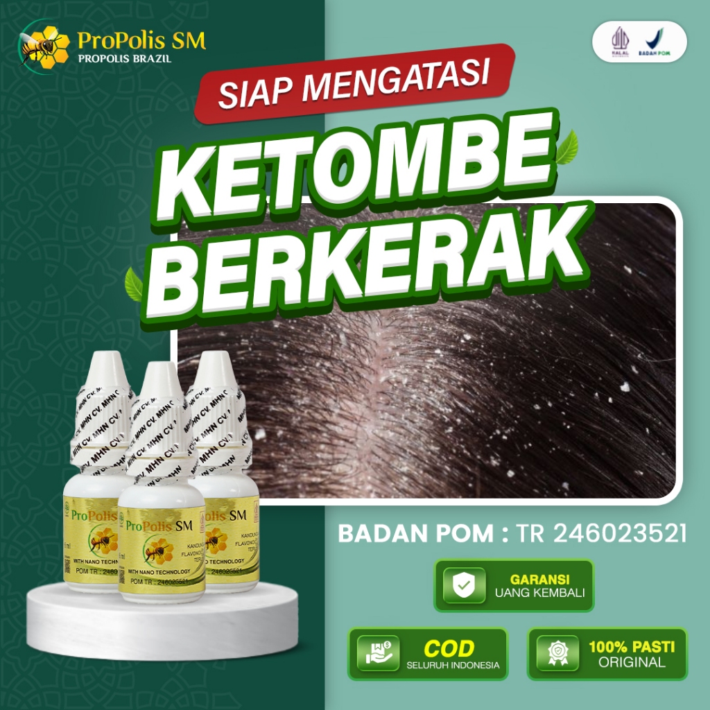 Jual Obat Oles Ketombe Rambut Berkerak Bersisik Psoriasis Scabies ...