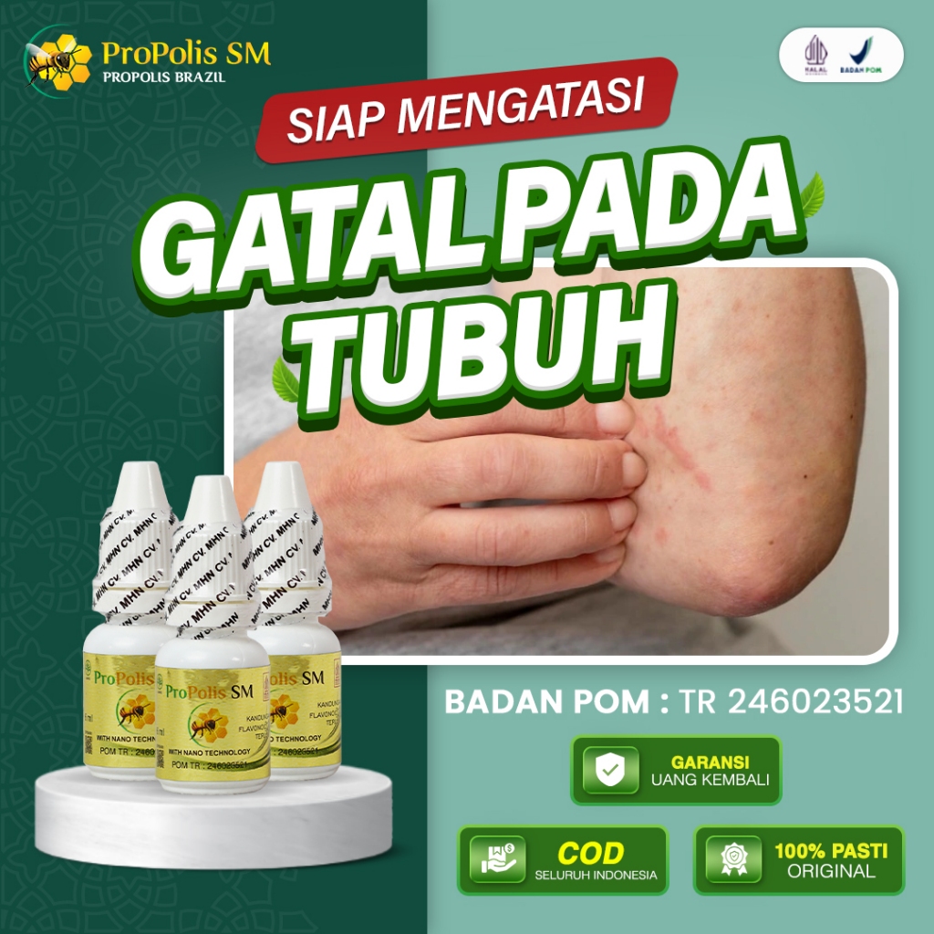 Jual Obat Gatal Pada Tubuh Area Selangkangan Buah Zakar Kepala Gatal ...