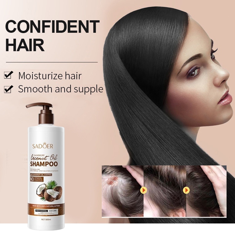 Jual Kelapa Shampoo Kelapa Shampoo anti ketombe sampo Singkirkan Ketombe Memperbaiki Kulit ...