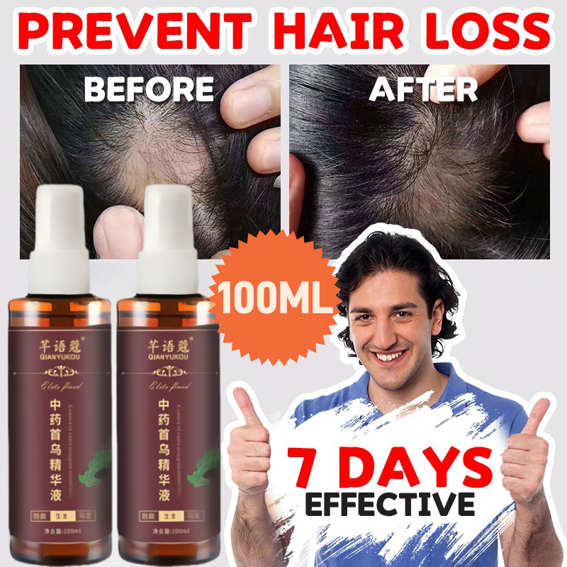Jual 【COD ORI】Serum Penumbuh Rambut Cepat / Serum Rambut Rontok ...