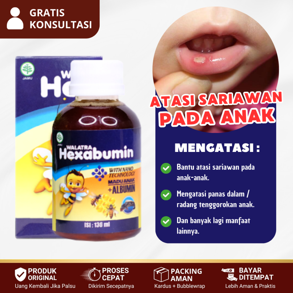 Jual Obat Sariawan Balita, Obat Sariawan Anak 1 Sampai 12 Tahun ...