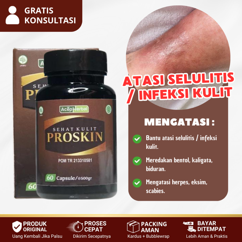 Jual Obat Selulitis Kaki / Tangan, Infeksi Kulit, Radang Kulit, Iritasi ...