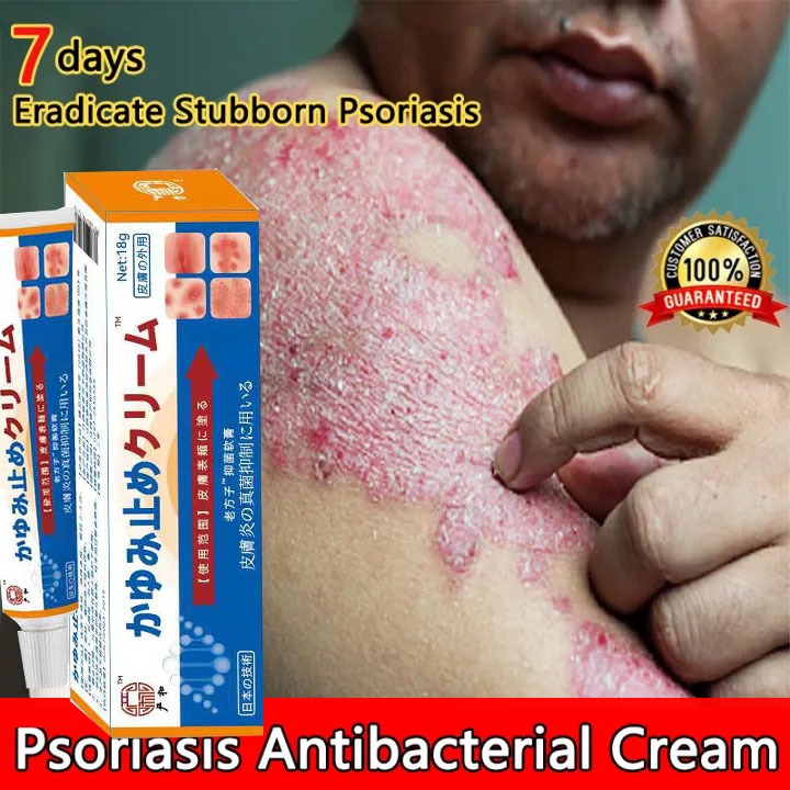 Jual Japan Salep gatal Salep Eksim Salep kulit Krim psoriasis paling ...