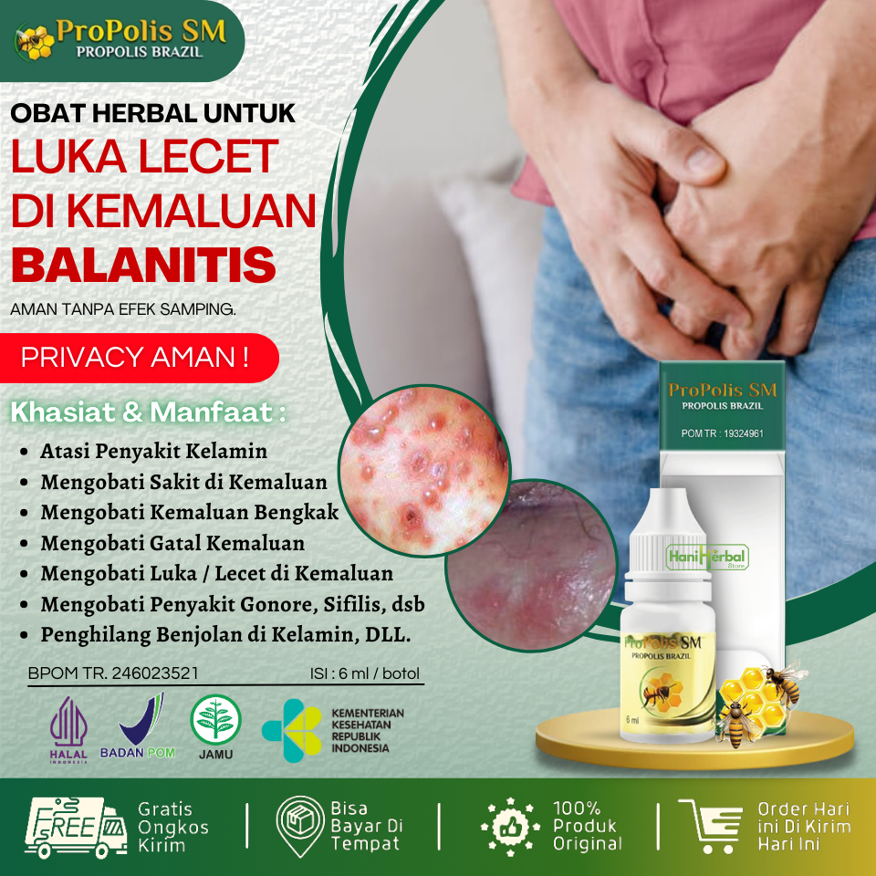 Jual PROPOLIS SM - Obat Herbal Atasi Penis Lecet dan Perih 100% Tanpa ...