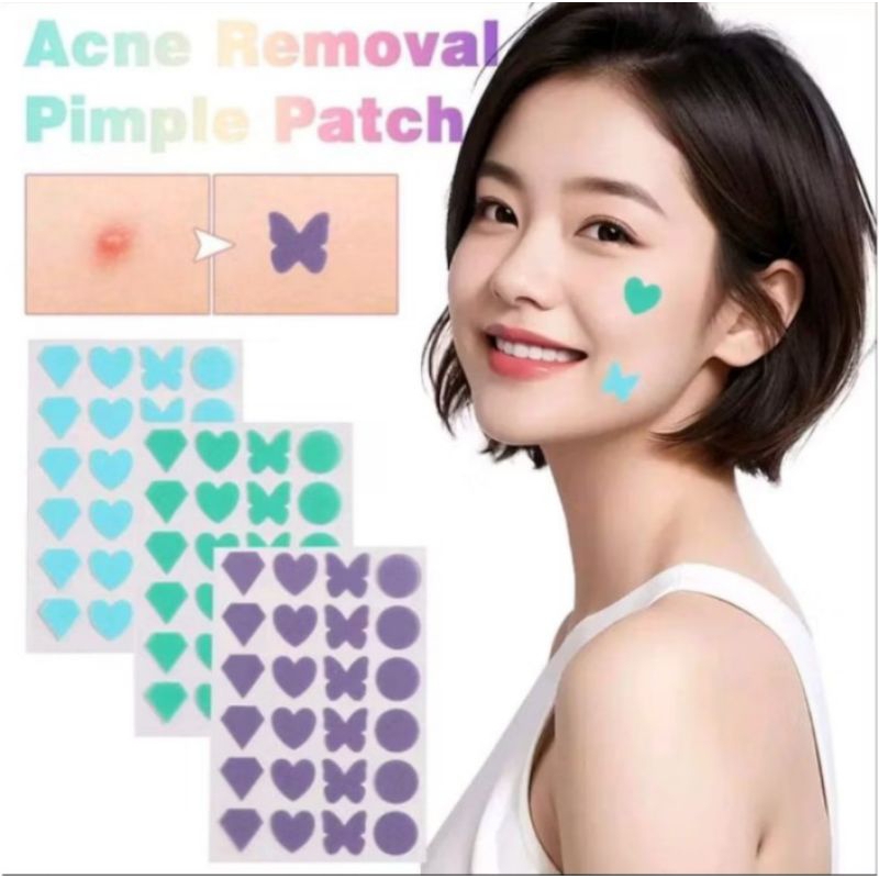 Jual Acne Patch Jerawat - Varian Lengkap | Shopee Indonesia